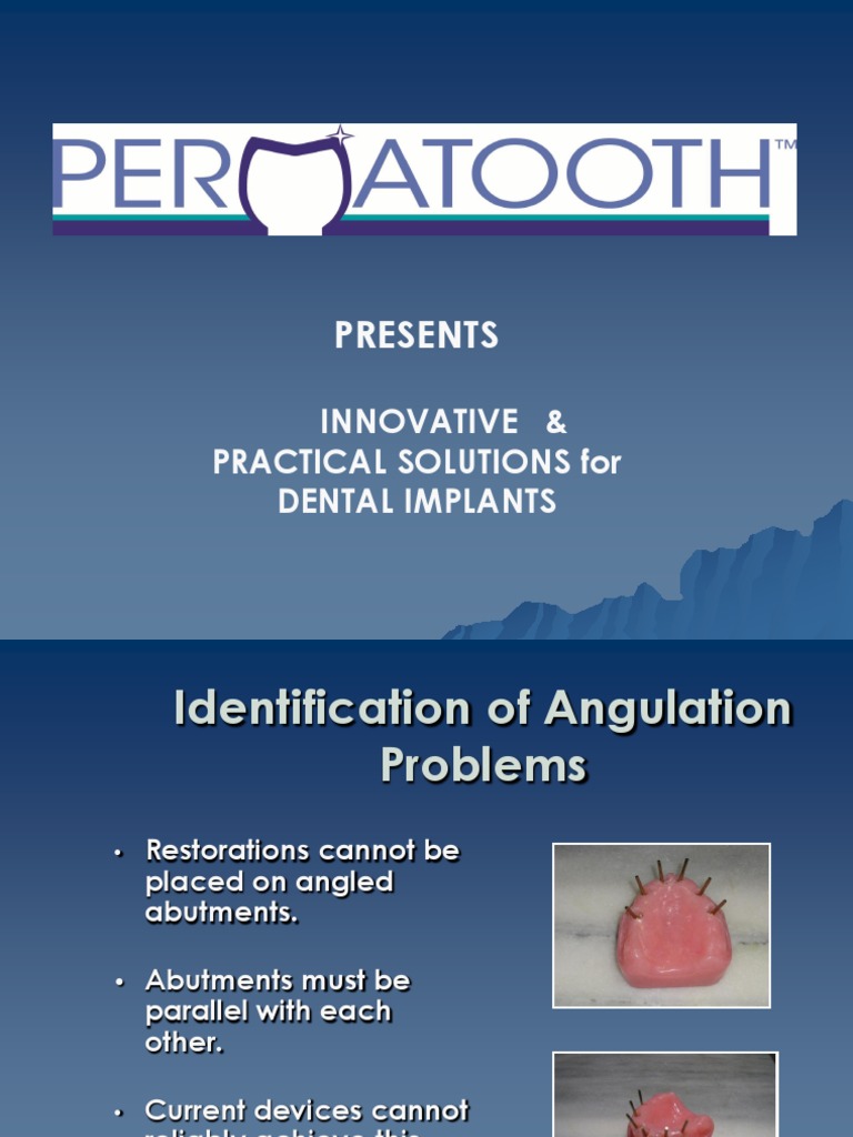 Dental Implant Angulation Solutions | PDF | Dental Implant | Mouth