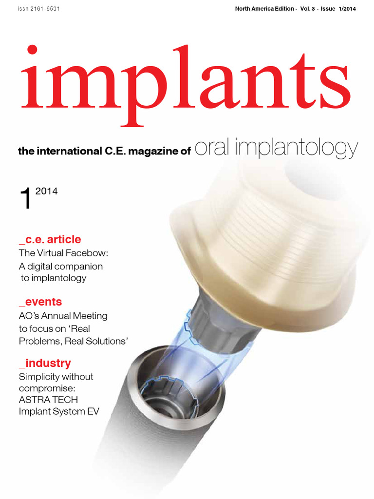 Implant Ce | PDF | Dental Implant | Dentistry