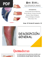 Quemaduras Faciales y Signos de Flogosis | PDF | Quemar | Inflamación