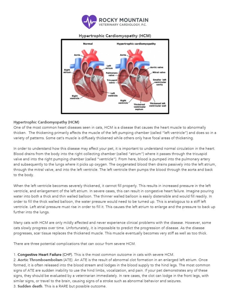 RMVC Hypertrophic Cardiomyopathy | PDF | Ventricle (Heart) | Heart