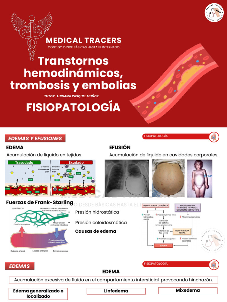 Fisiopatología de Edema y Shock Médico | PDF | Edema | Embolia