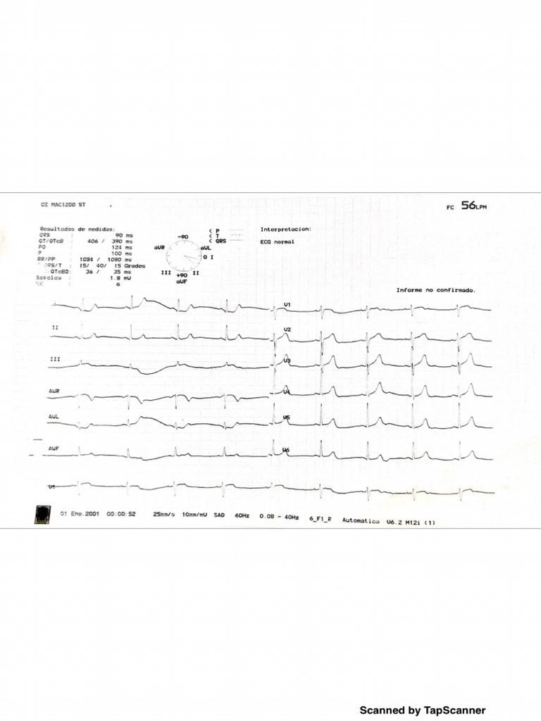 Interpretación Electro | PDF