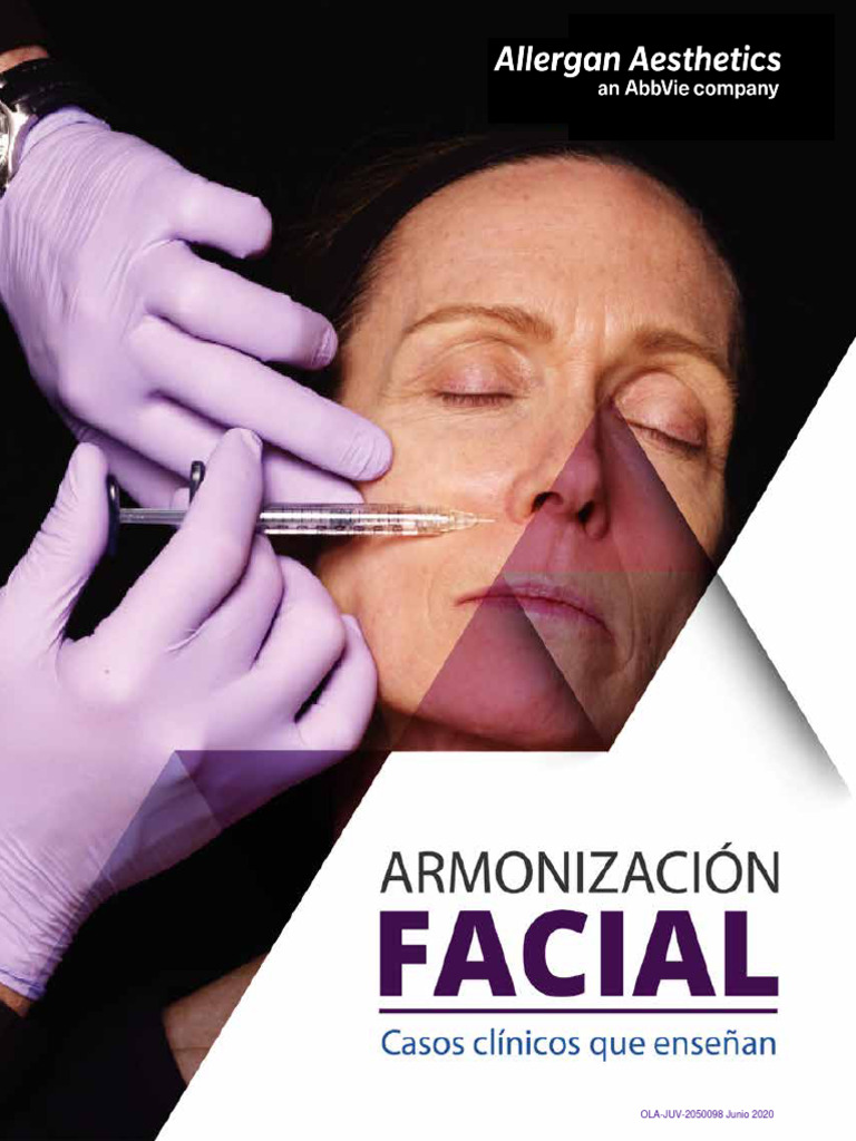 Libro Armonización Facial ALLERGAN | Descargar gratis PDF | Cara | Cabeza y cuello humanos