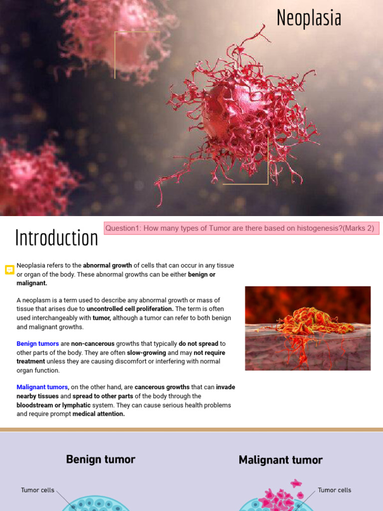 Neoplasia | PDF | Cancer | Neoplasms
