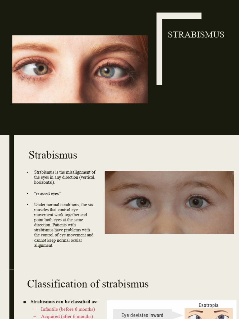 Opthalmology Present | PDF | Vision | Human Eye