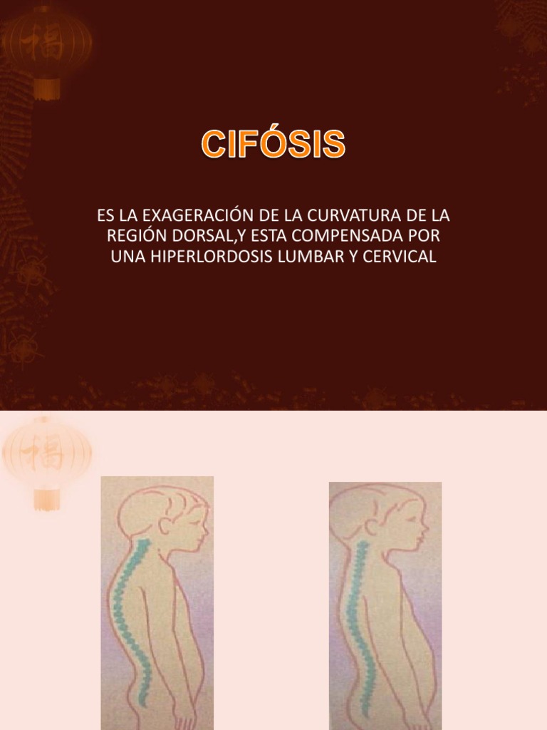 8 Ejercicios para Cifosis | PDF | Términos anatómicos de ubicación | Tórax