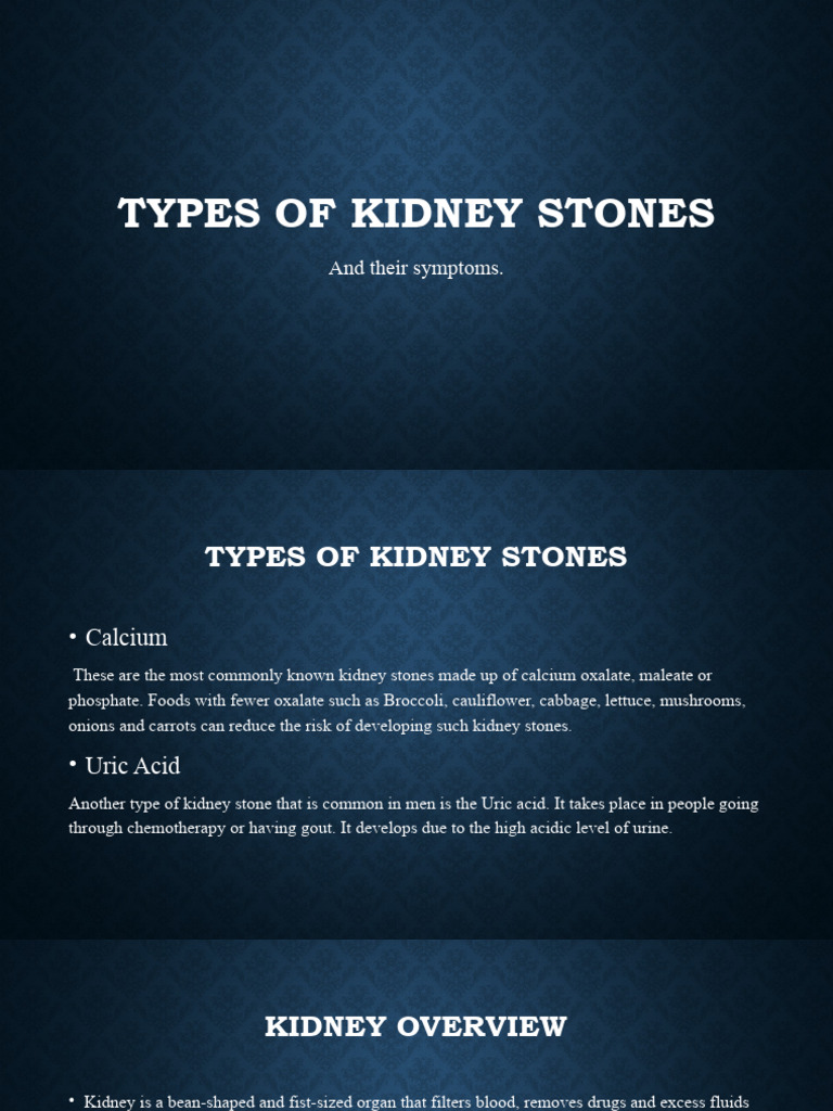 Kidney Stones | PDF | Kidney | Urine
