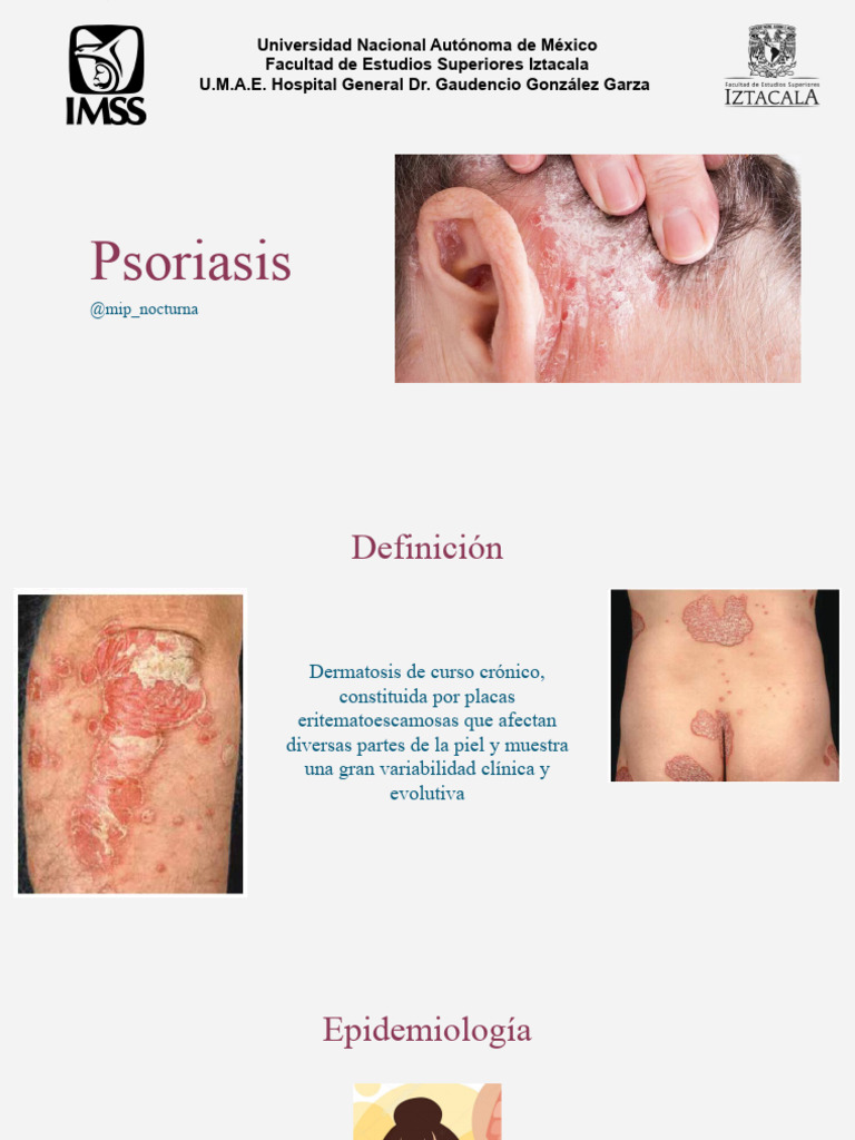Psoriasis | PDF | Psoriasis | Dermatología