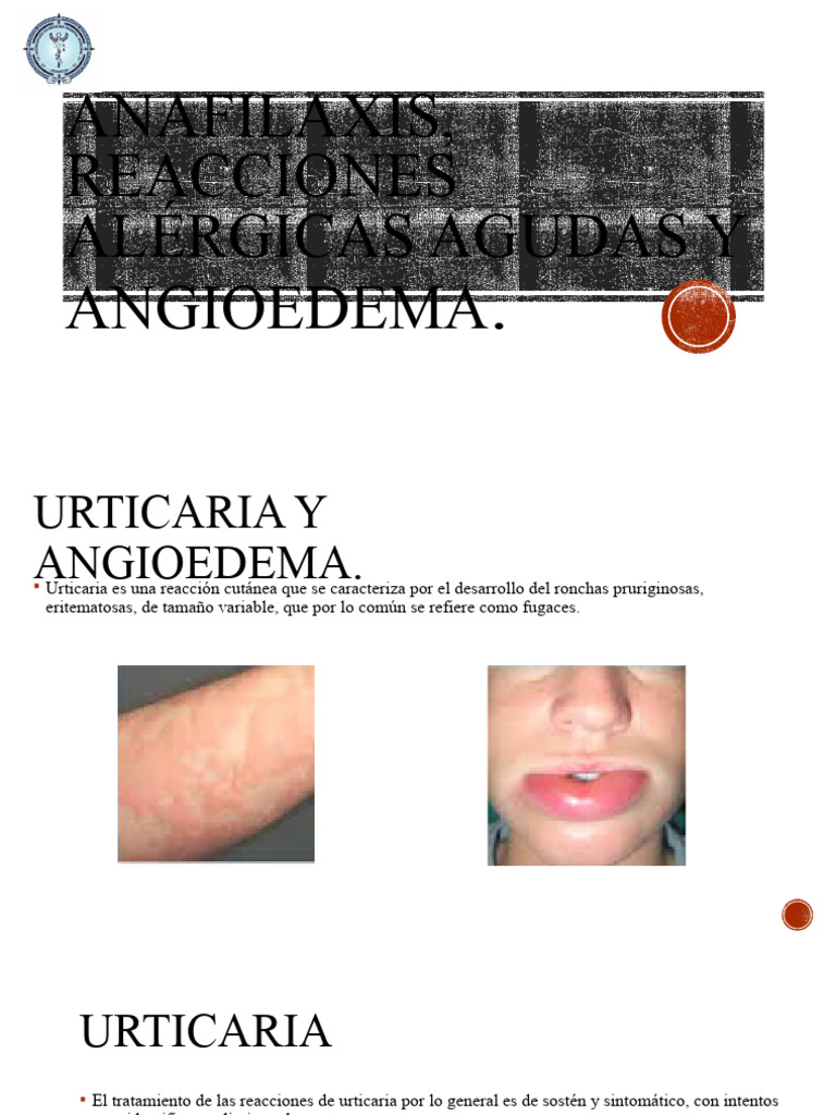Anafilaxis, Reacciones Alérgicas Agudas y Angioedema | PDF | Alergia ...