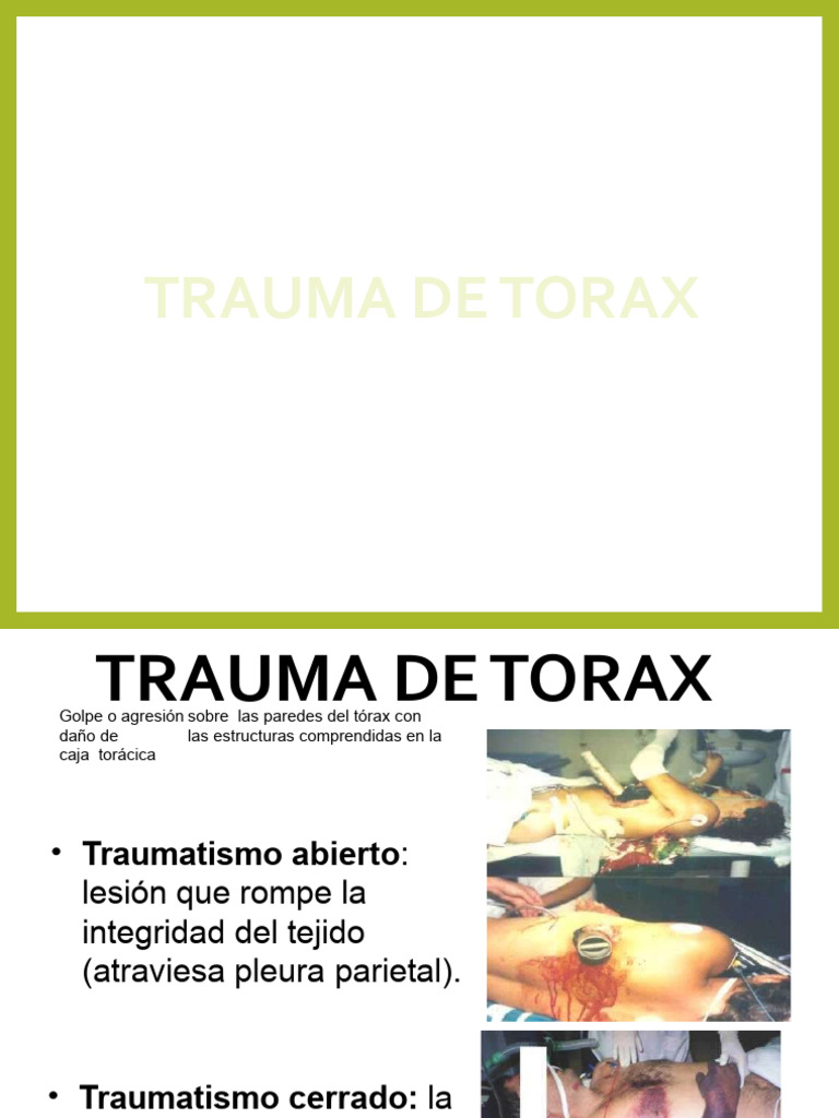 trauma_torax completo[1] | PDF | Tórax | Neumología