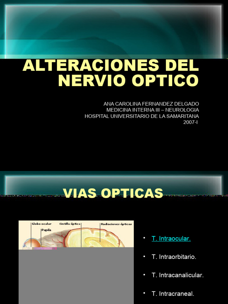 Alteraciones Del Nervio Optico | PDF | Percepción visual | Glaucoma