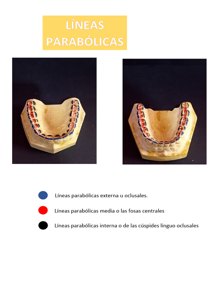 Líneas Parabólicas | PDF