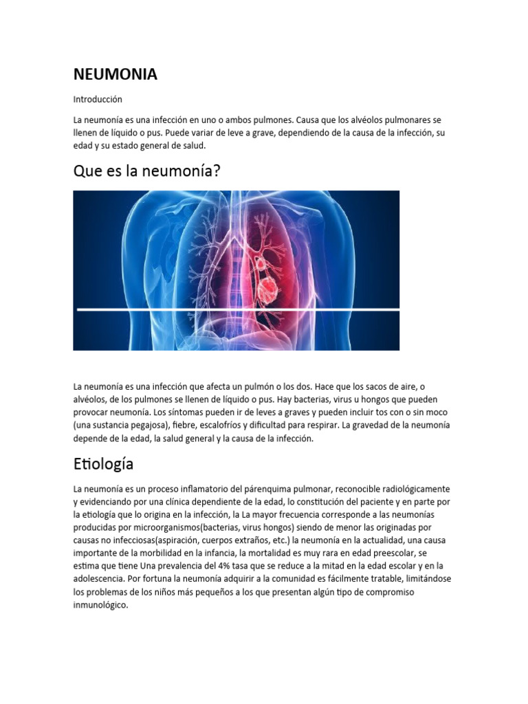 NEUMONIA | PDF | Neumonía | Tos