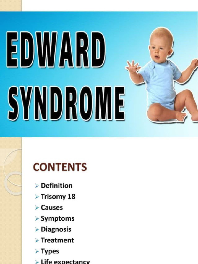 Edward Syndrome | PDF
