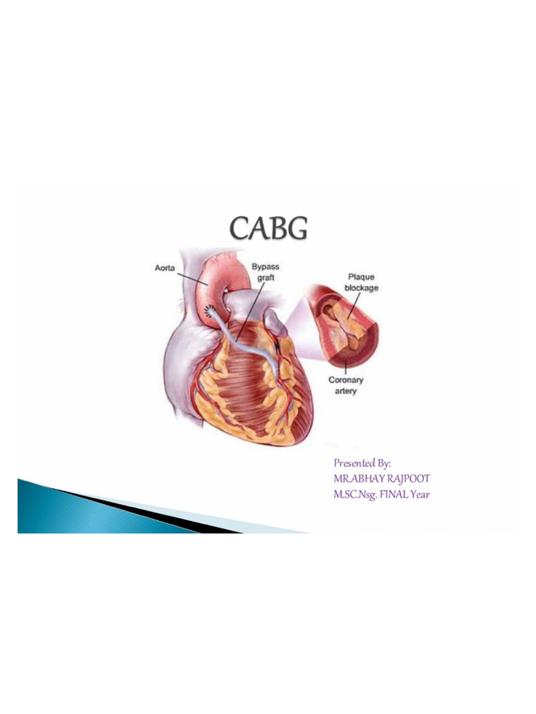 Cabg | PDF
