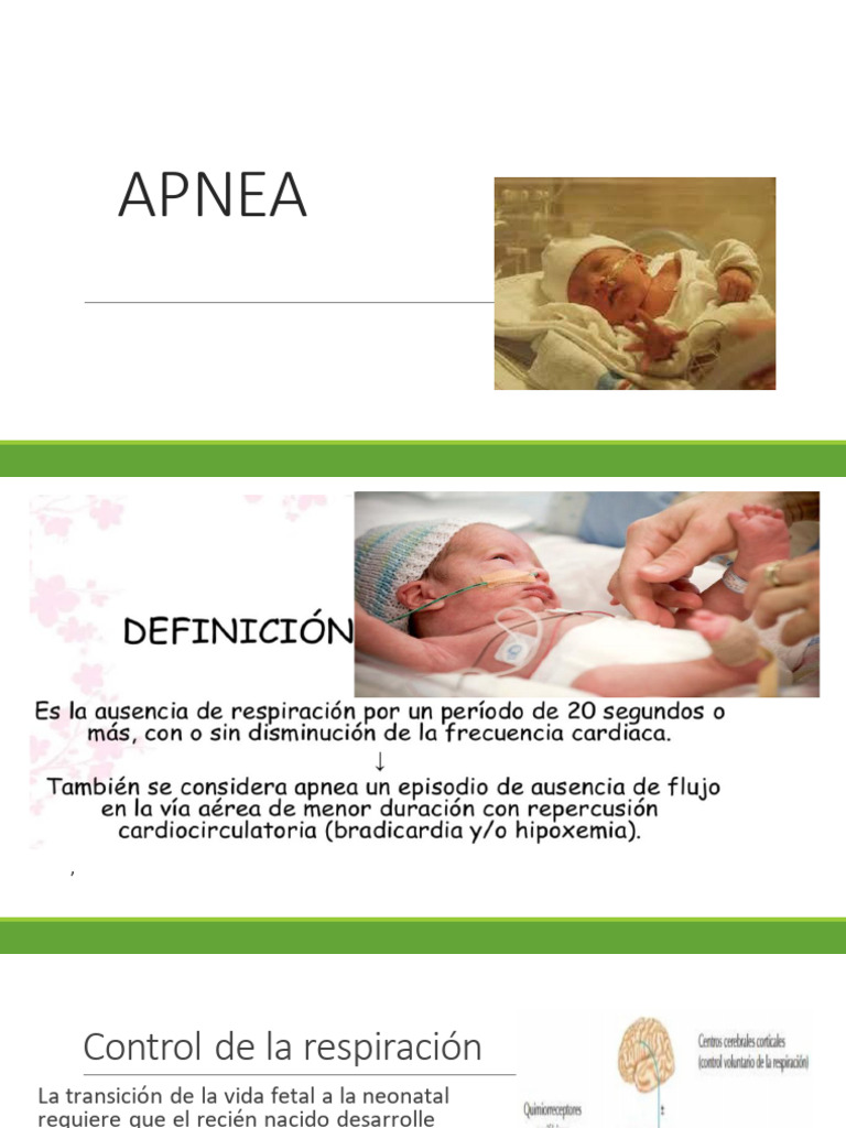 Apnea en Prematuros: Diagnóstico y Manejo | PDF | Apnea | Sistema ...