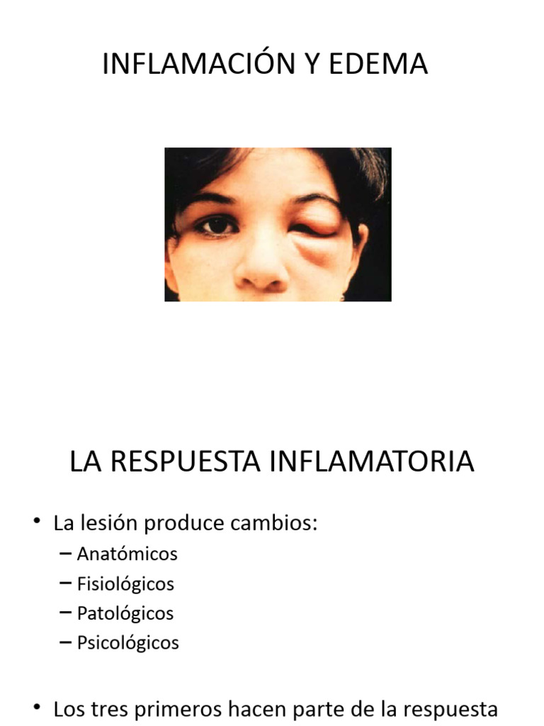 Inflamacion Edema | PDF | Inflamación | Biología