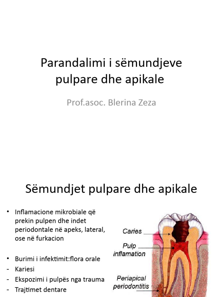 Parandalimi I Semundjeve Pulpare Dhe Periodontale | PDF