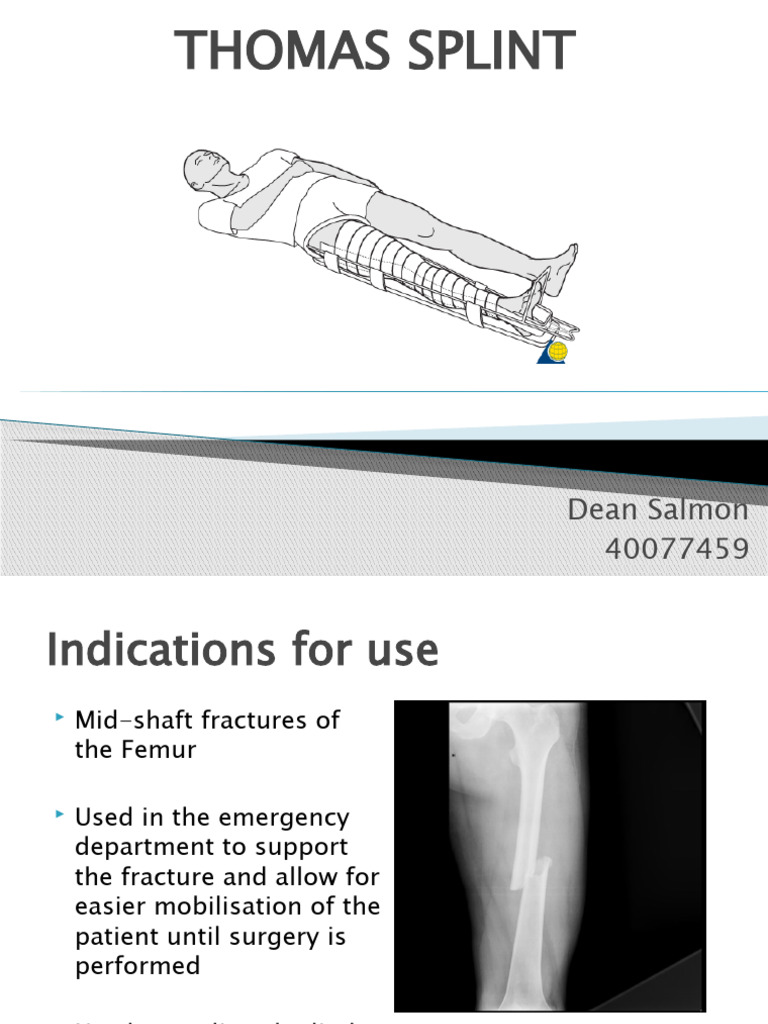 Thomas Splint Pdf Musculoskeletal System