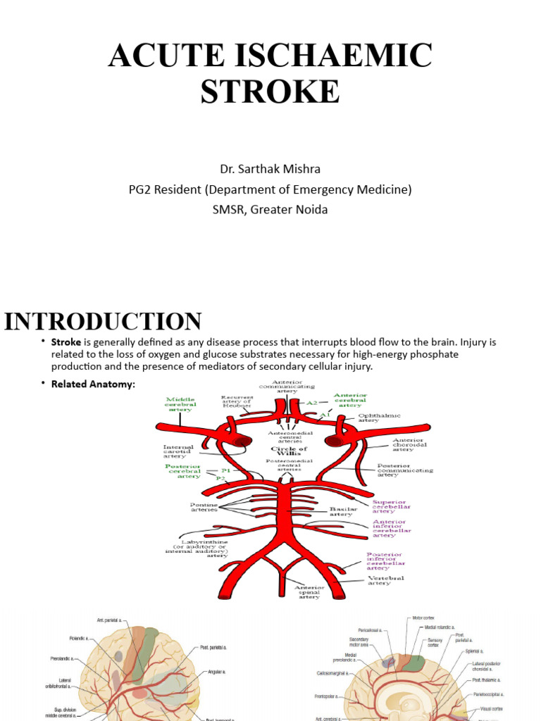 Acute Ischaemic Stroke | PDF | Stroke | Ischemia