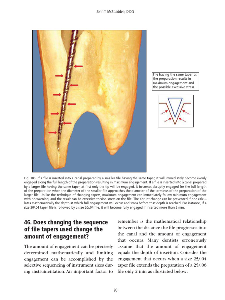 Mastering Endodontic Instrumentation (100-200) | PDF | Curvature ...