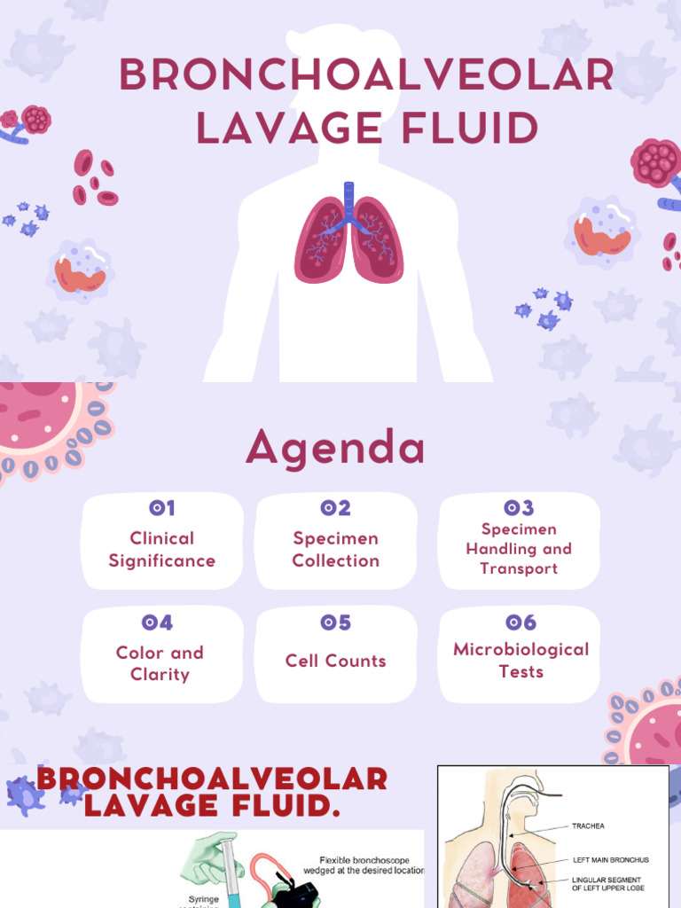 Aubf Bbroncho-Alveolar Lavage | Download Free PDF | Pneumonia | Infection