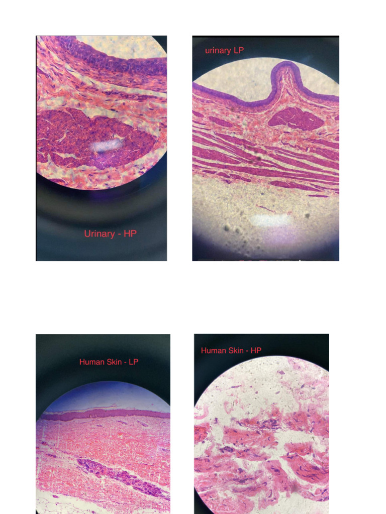 HISTO | PDF