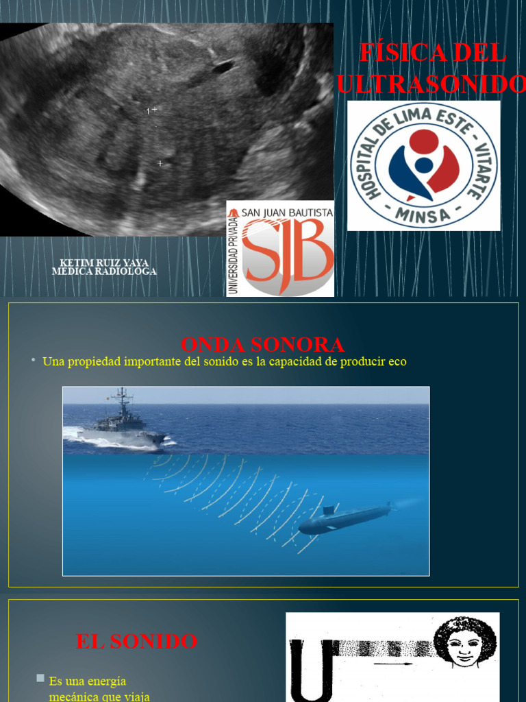 Fisica Del Ultrasonido | Descargar gratis PDF | Sonido | Ultrasonido