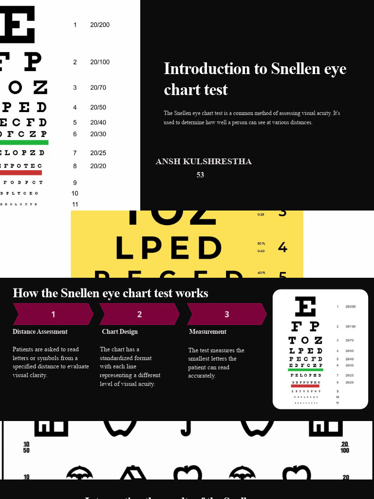 Eye test | PDF