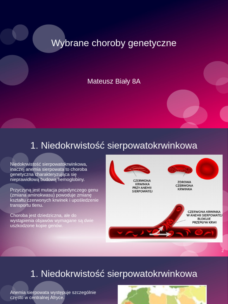 Mateusz Bialy 8a - Choroby Genetyczne | PDF