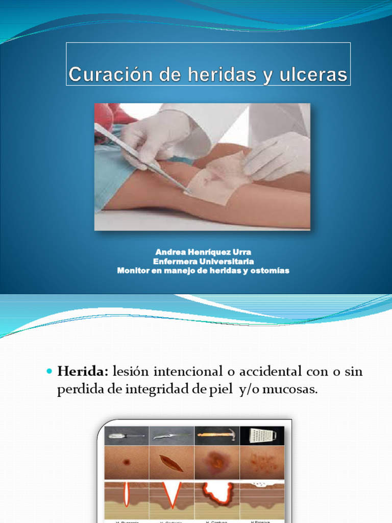 Curacion Avanzada | PDF | Herida | Cicatrización de la herida