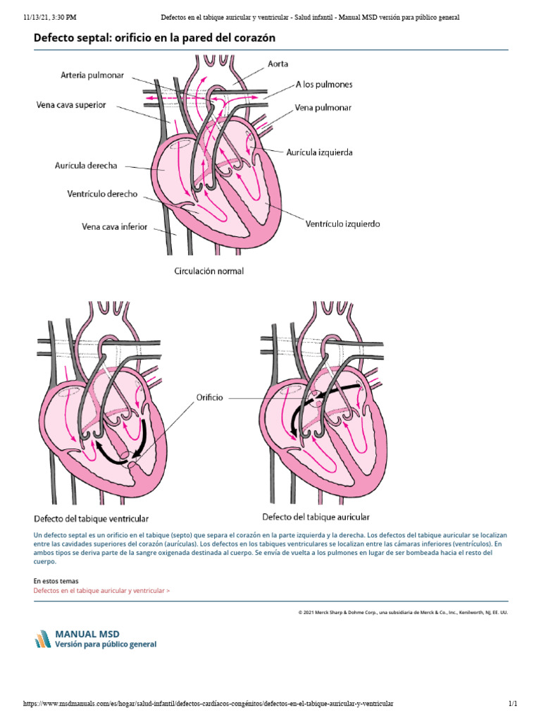 Defectos en El Tabique Auricular y Ventricular - Salud Infantil ...