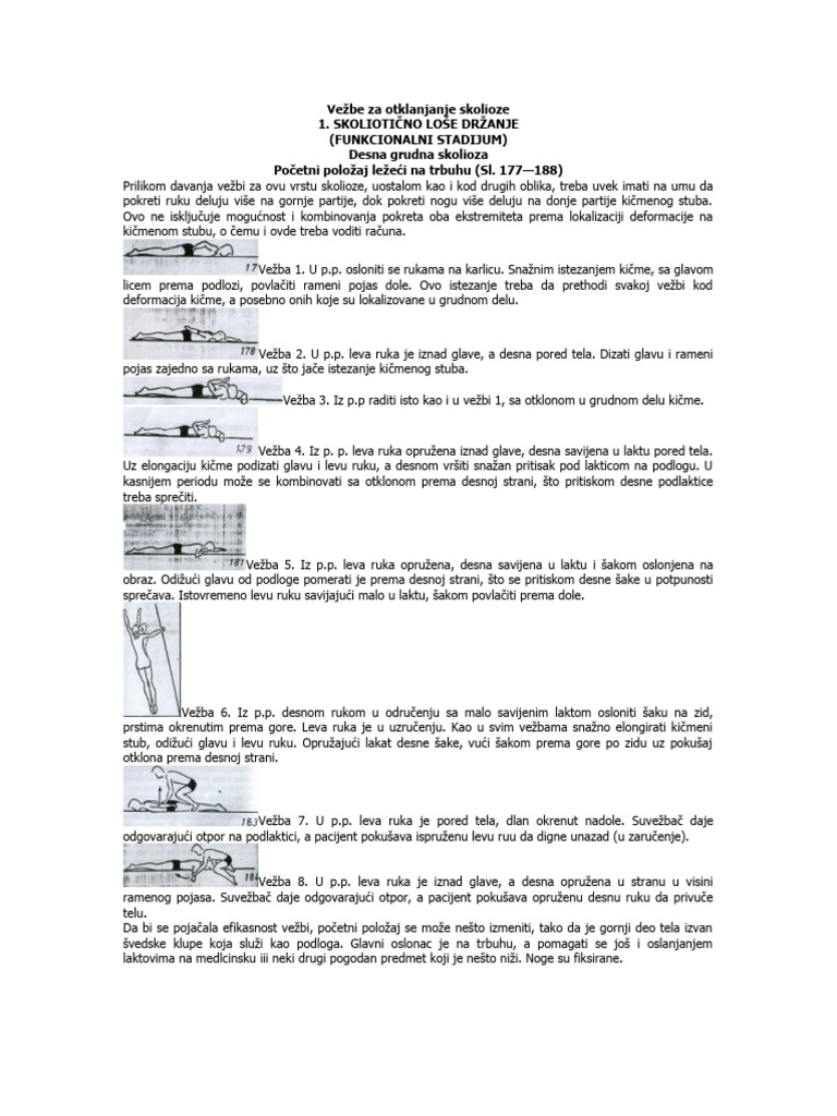 SKOLIOZA Za Pacijente | PDF