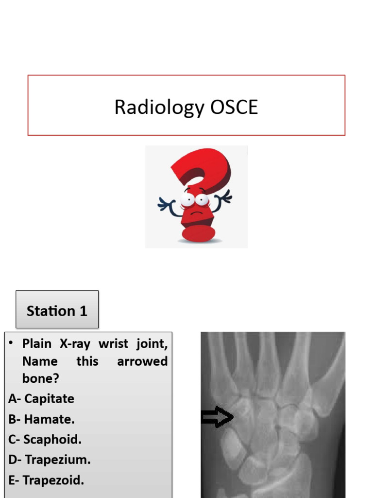 Radiology OSCE Practice Questions | PDF | Radiology | Interventional Radiology