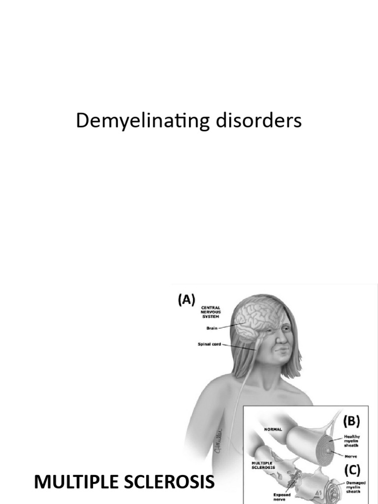 Demyelinating Disorders | Download Free PDF | Multiple Sclerosis | Myelin