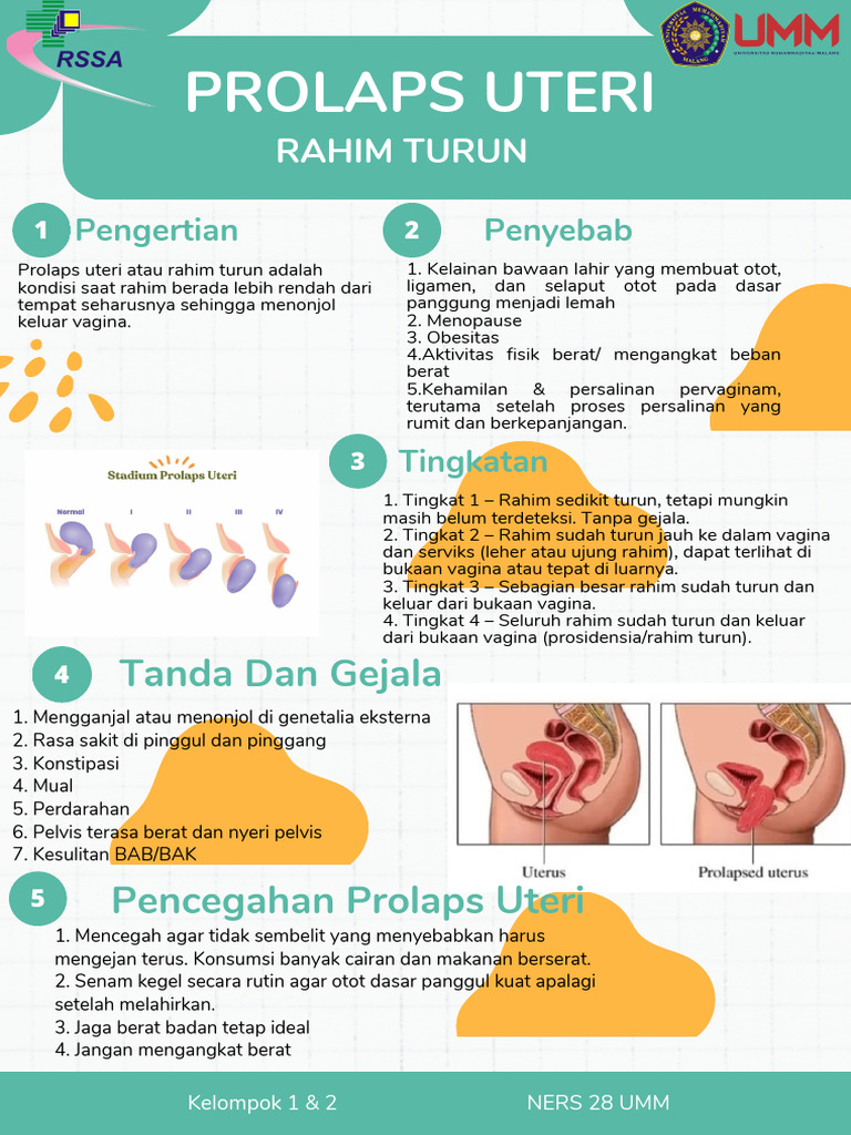 Poster Prolaps Uteri | PDF