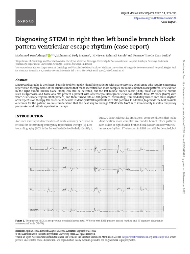 Diagnosing STEMI in Right Then Left Bundle Branch Block Pattern ...