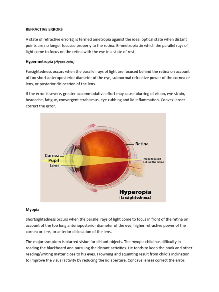 Refractive Errors | PDF | Myopia | Medical Specialties