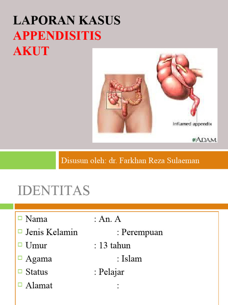 Vdocuments - MX - Laporan Kasus Appendisitis Akut 56b4af4b6bfaa | PDF