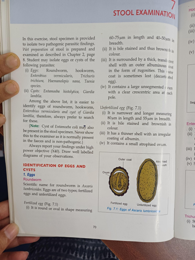 Stool Examination | PDF