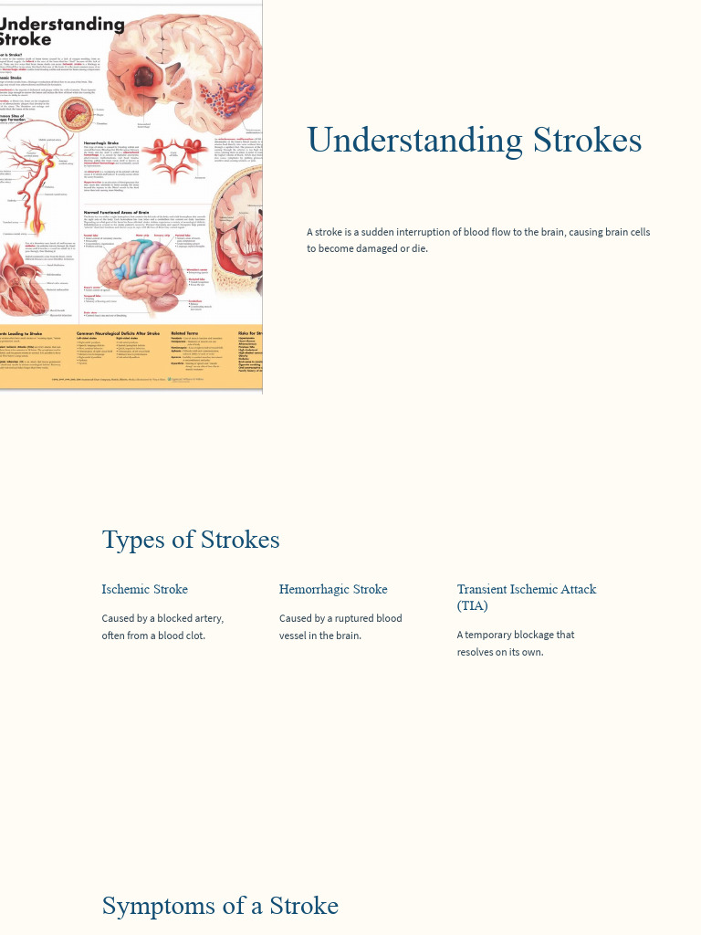Understanding Strokes | PDF