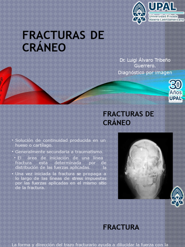 Fracturas de Cráneo PDF | PDF | Cráneo | Sistema esquelético