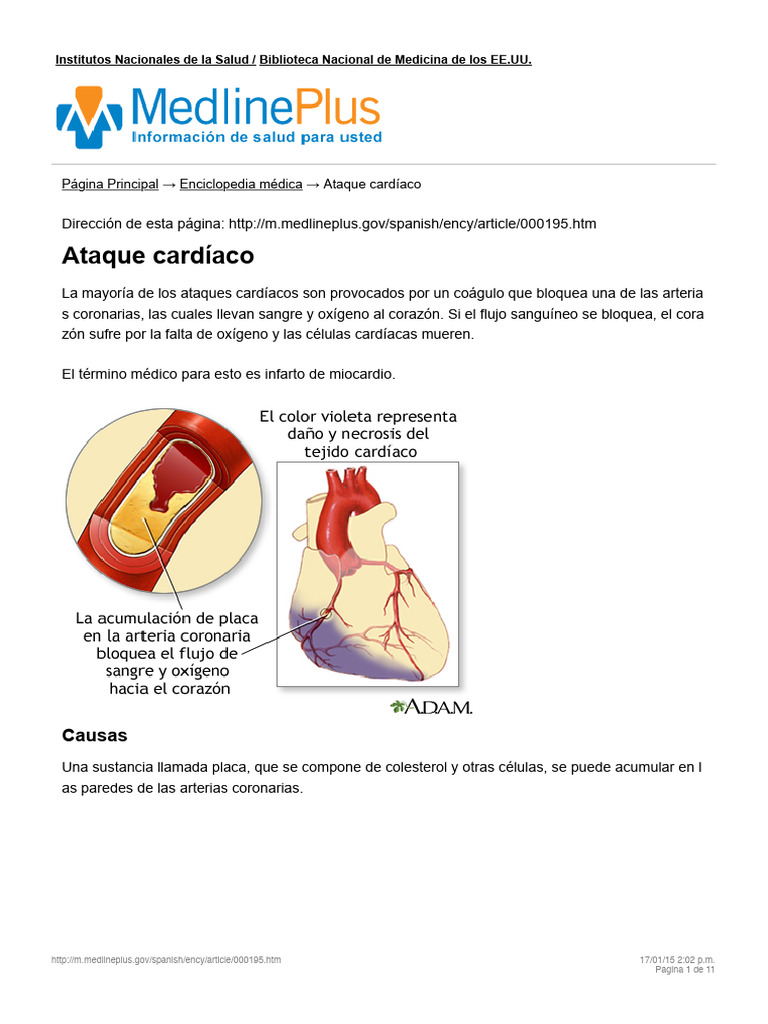 Ataque Cardíaco - MedlinePlus Enciclopedia Médica | Descargar gratis ...