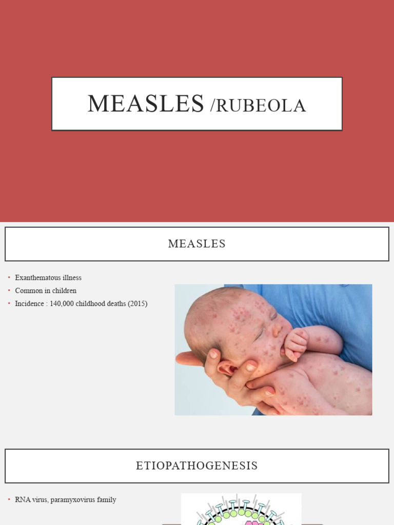 Measles | PDF | Measles | Vaccines