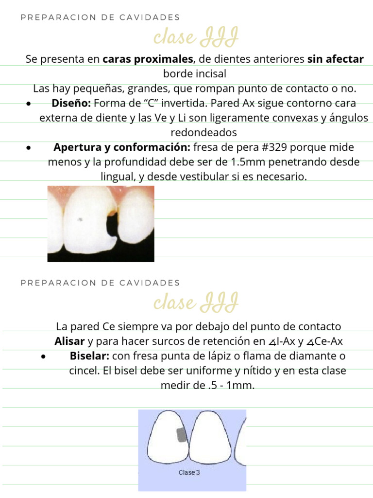 Cavidad Clase III | PDF