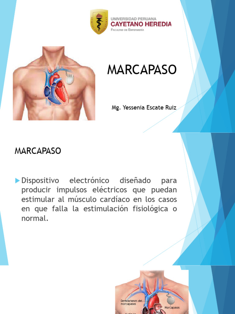 Marcapaso 2024 | Descargar gratis PDF | Marcapasos cardíacos ...