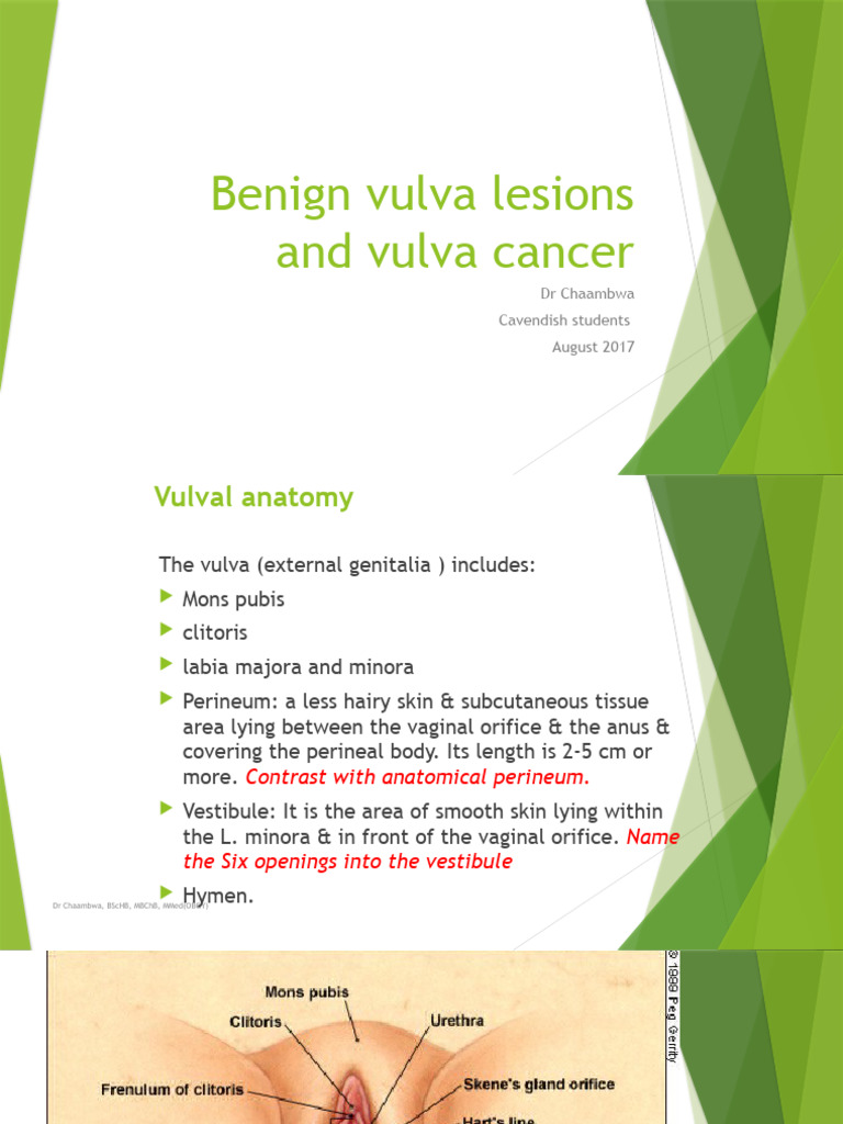 Benign Vulva Lesions | PDF | Medical Specialties | Diseases And Disorders
