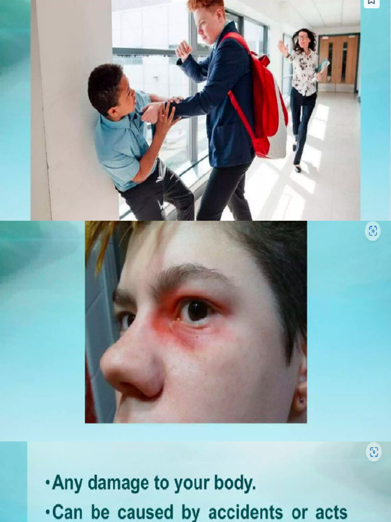 Intentional Injuries | PDF | Bullying | Violence