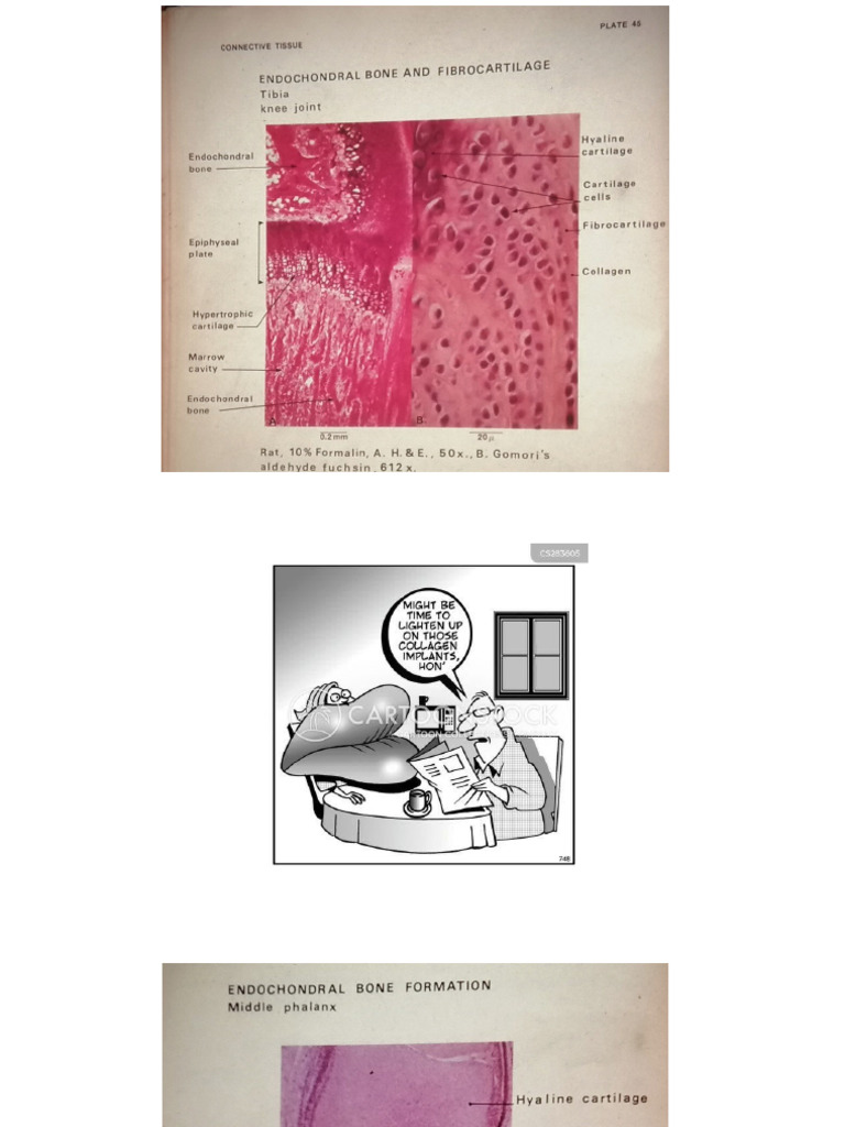 Lab 4 - Slides and Case Studies-The Cartilage | PDF
