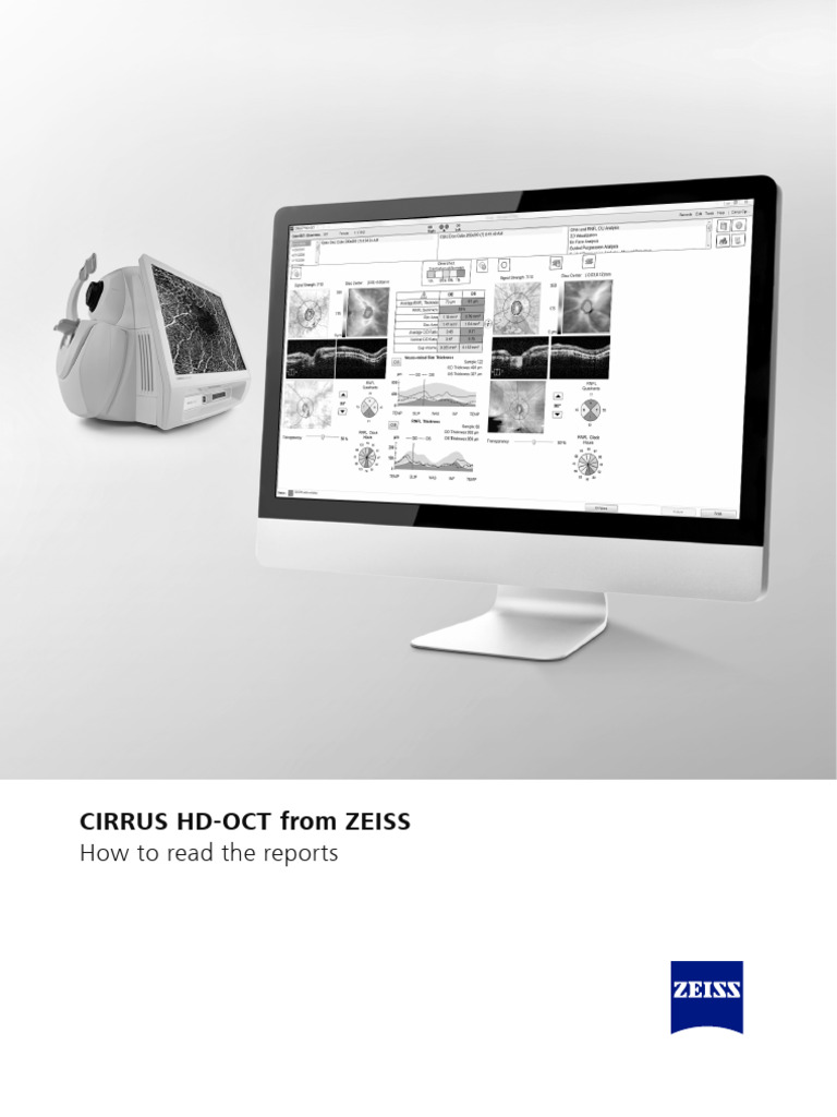 Cirrus | PDF | Retina | Angiography